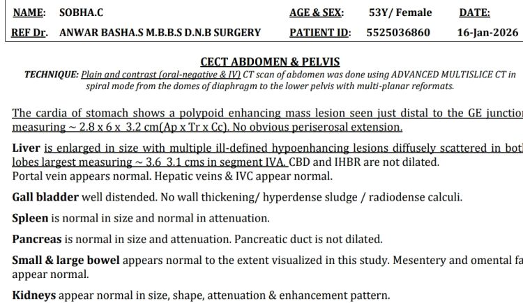 My Mother Is Suffering From Stage 4 Liver Cancer. We Need Your Help To ...