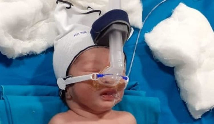 Premature Baby Boy Born With Underdeveloped Lungs. - Ketto