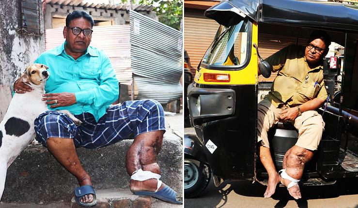 Poor Rickshaw Driver Who Loves Animals Needs Your Help For His Leg ...