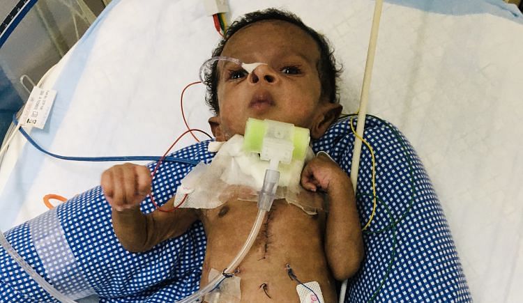 My Newborn Baby Is Suffering From Post Operative Heart Surgery Problems ...