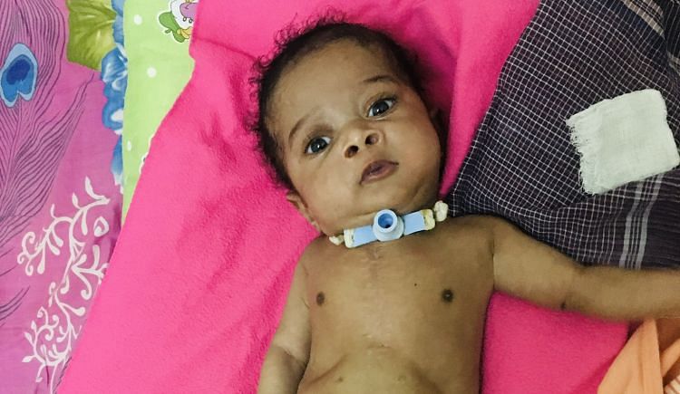 My Newborn Baby Is Suffering From Post Operative Heart Surgery Problems ...