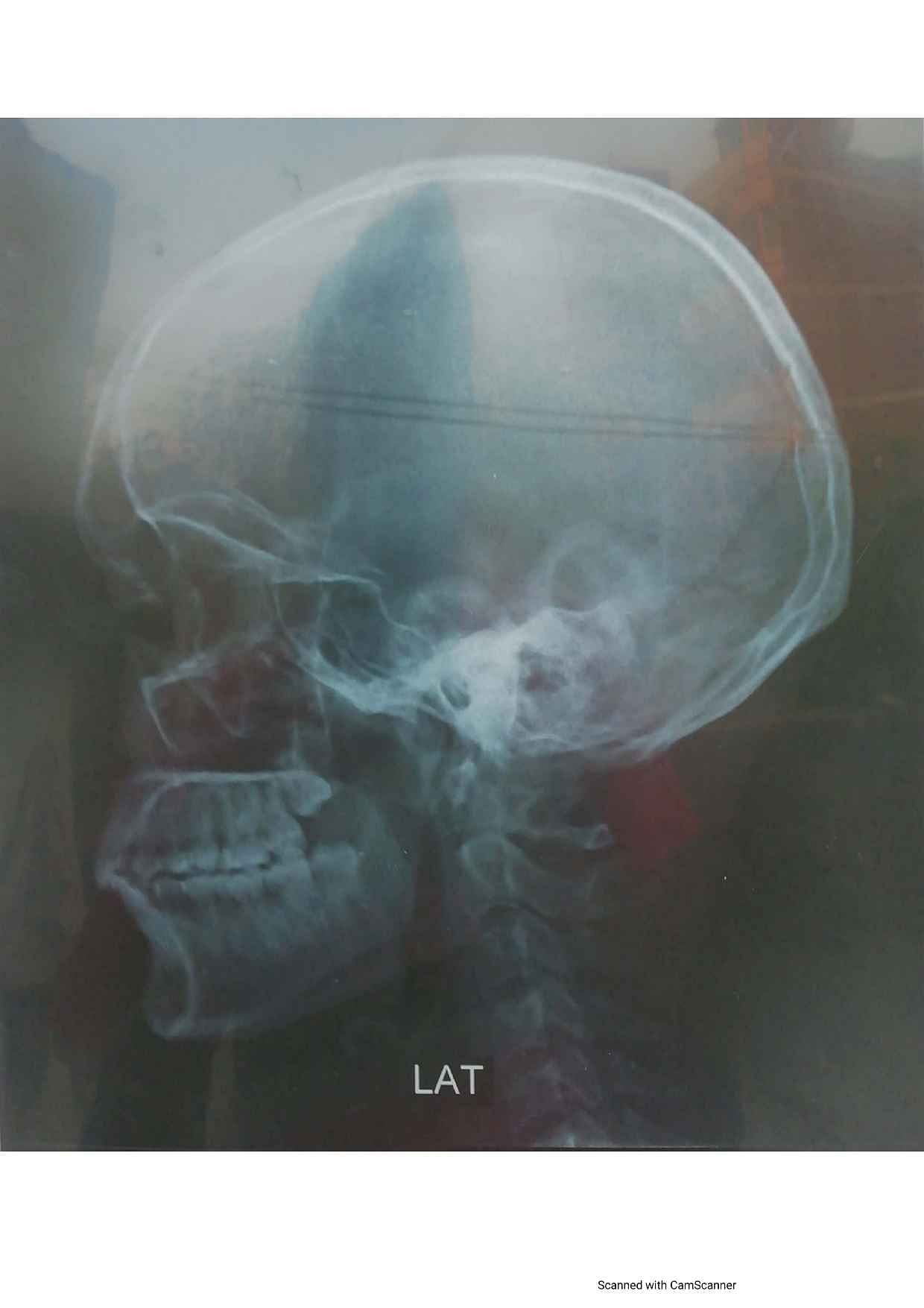 Offer A Helping Hand To Support Md Sadaf 's Treatment - Ketto