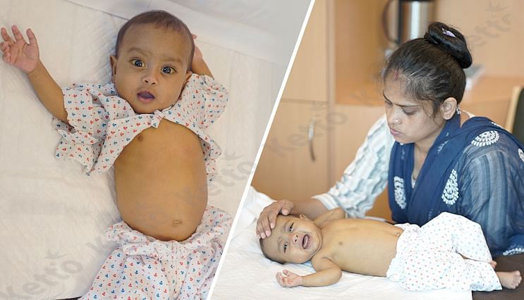 Without A Liver Transplant, My Baby Won’t Survive. Please Help Me Save Him! - Ketto
