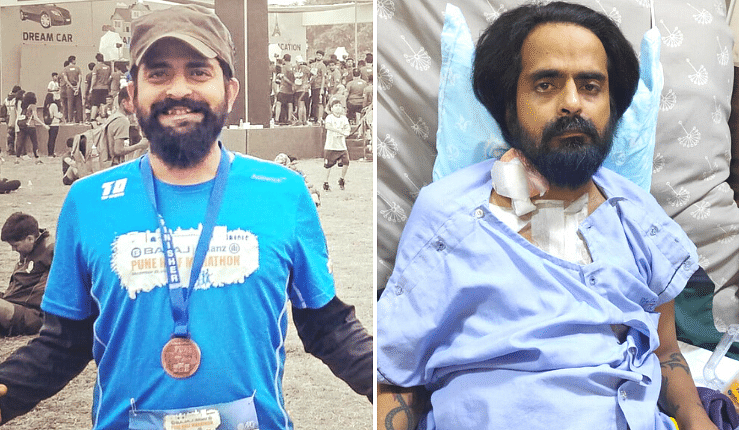 38-YO Ashwin Dixit Is Suffering From Kidney Disease & Paralysis Due To Open Heart Surgery ...