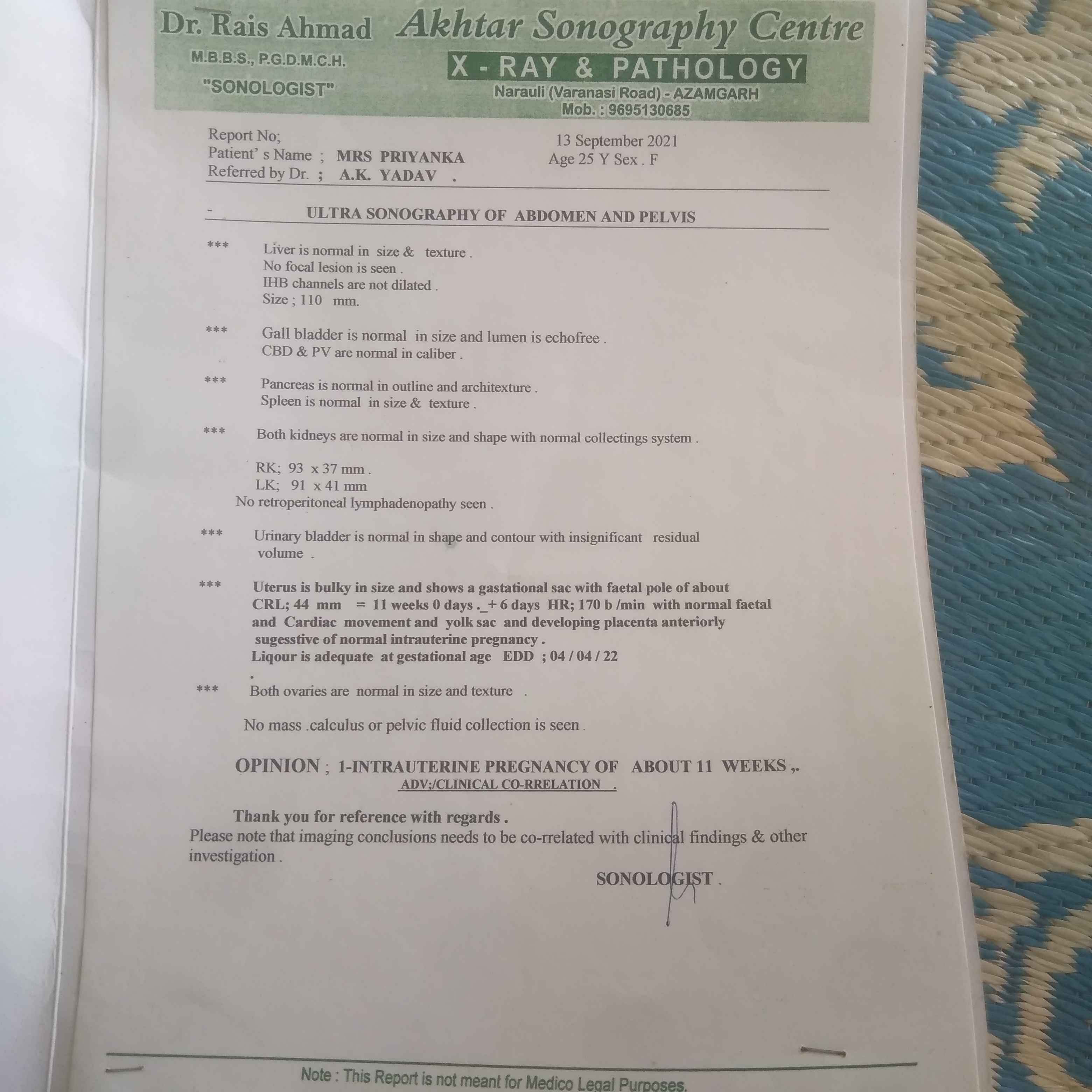 My Wife Is Suffering From DRESS Syndrome (Drug Rash With Eosinophilia ...