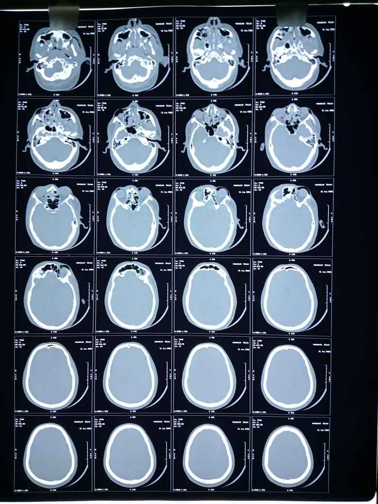 My Uncle Is Suffering From Head Injury. We Need Your Help To Provide ...