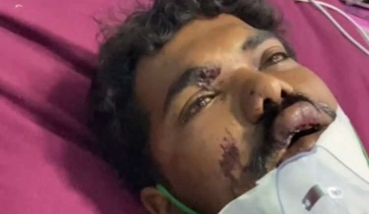 My Uncle Is Suffering From Head Injury. We Need Your Help To Provide ...