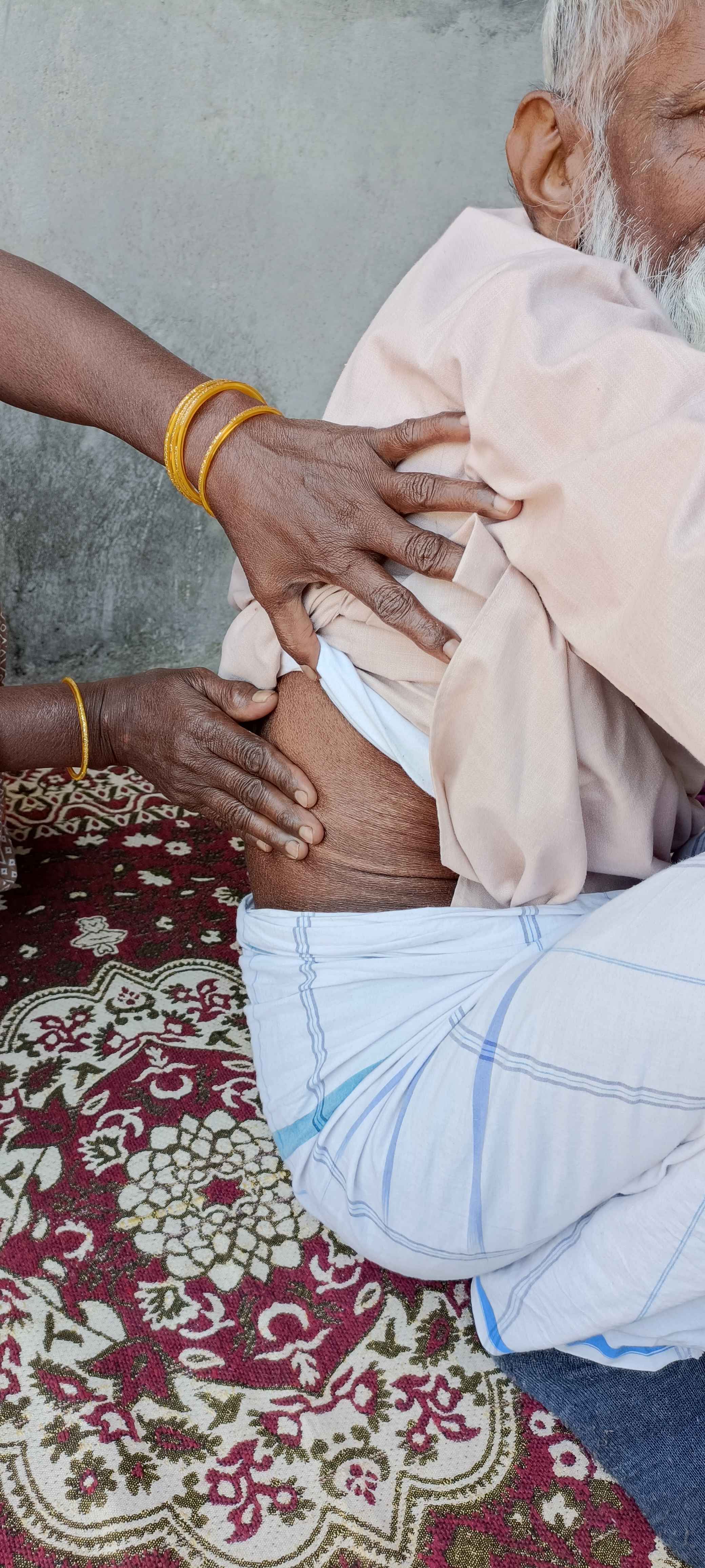 My Father Is Suffering From DRESS Syndrome (Drug Rash With Eosinophilia ...