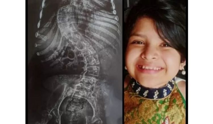 Offer A Helping Hand To Support Keya Hatkar's Treatment - Ketto