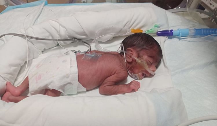 Help This Baby Get A Second Chance At Life - Ketto