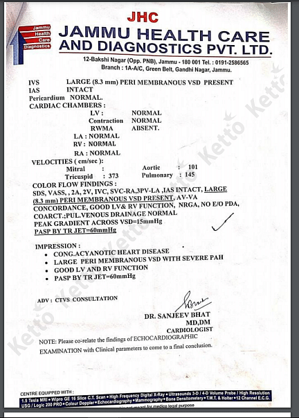 Help Us Save Baby Rukaya! - Ketto