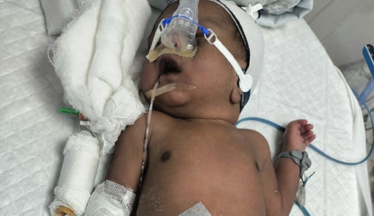 21 Days Aged Baby Is Suffering From Severe Lung Infection. We Need Your ...