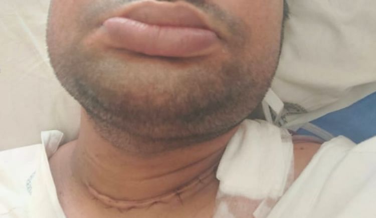 I Need Your Urgent Support For My Papillary Thyroid Carcinoma Treatment Ketto
