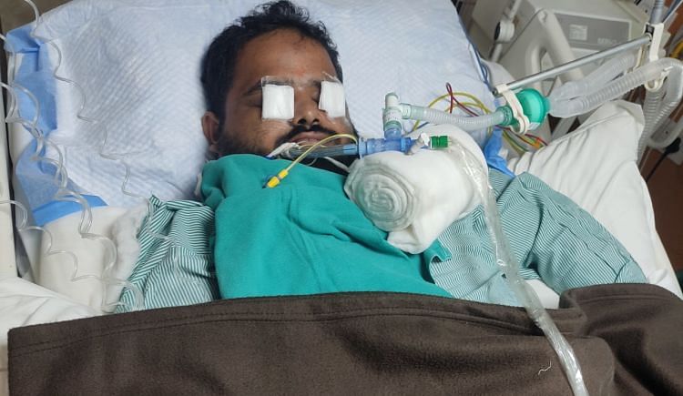 My Brother Is Suffering From Multiple Organ Dysfunction Syndrome (MODS ...