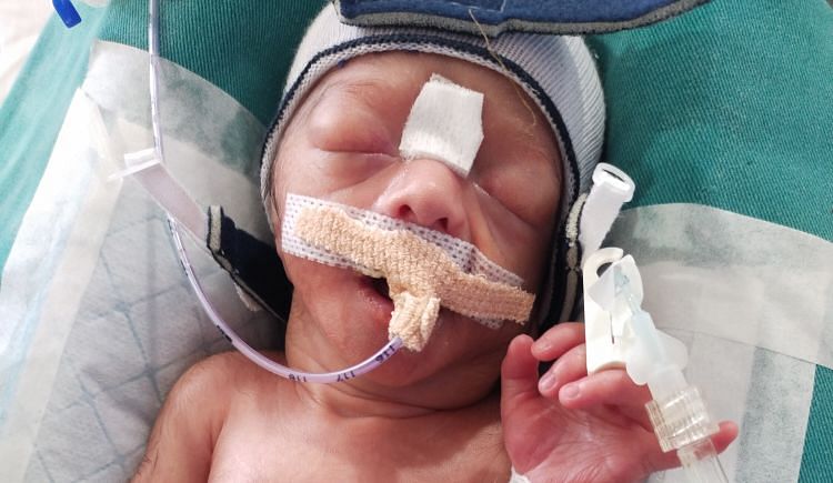 My Baby Battles For Her Life And We Need Your Support To Save Her - Ketto