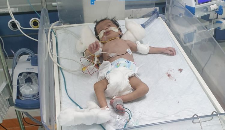 My Baby Battles For His Life And We Need Your Support To Save Him - Ketto