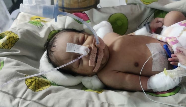 My Baby Is Battling For Life Just A Few Days Into This World! Help Me ...