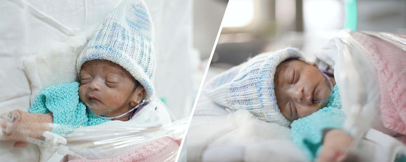 Weighing Less Than 1 Kg, Premature Baby Is Battling Respiratory ...