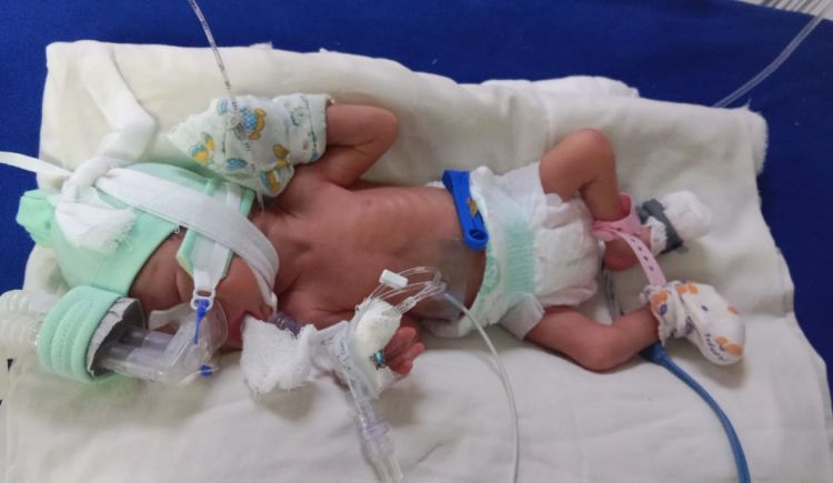 My Baby Battles For His Life And We Need Your Support To Save Him - Ketto