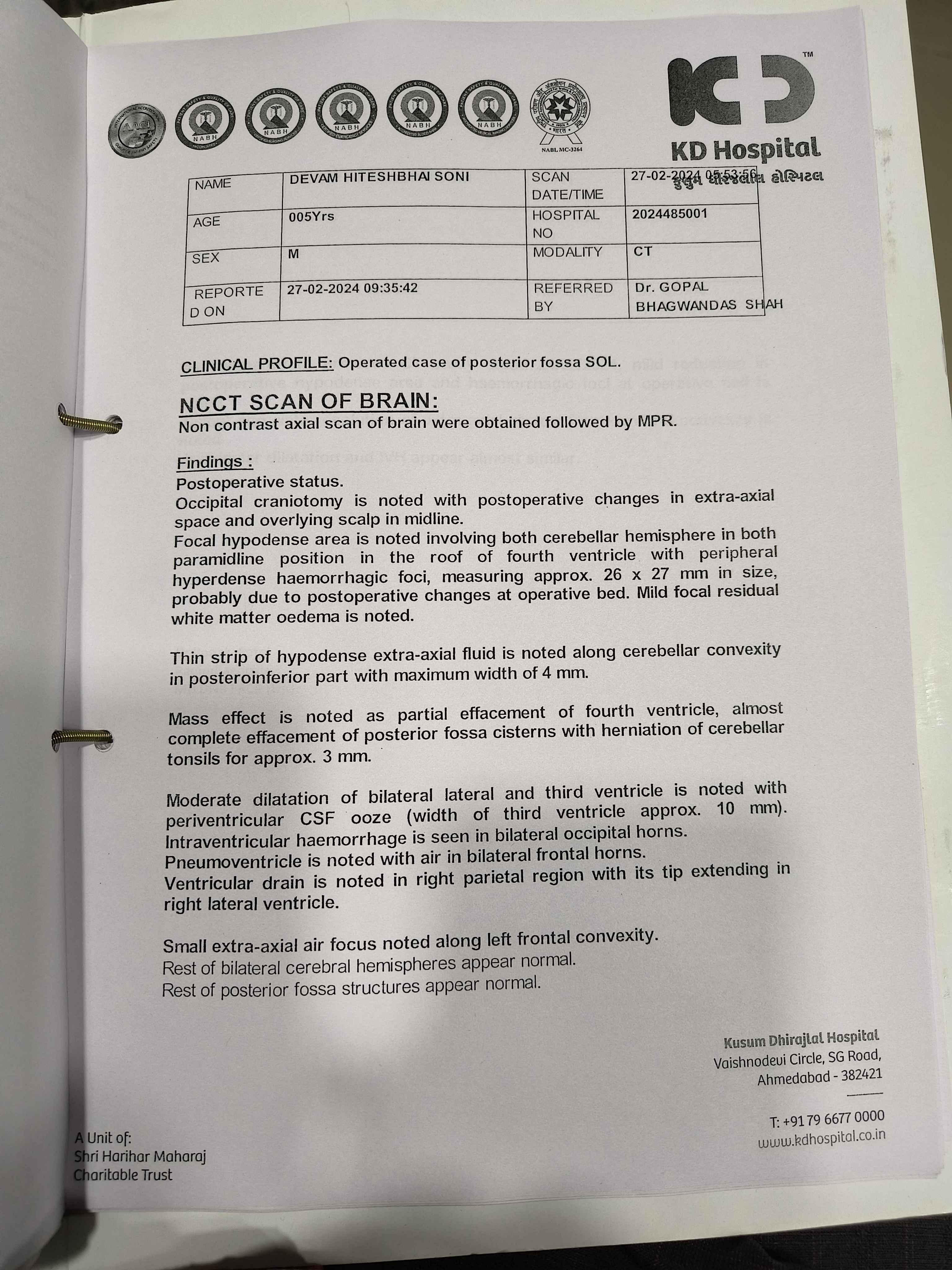 Help Devam My 5 Year Old Son Overcome Medulloblastoma CNS Grade 4 - Ketto