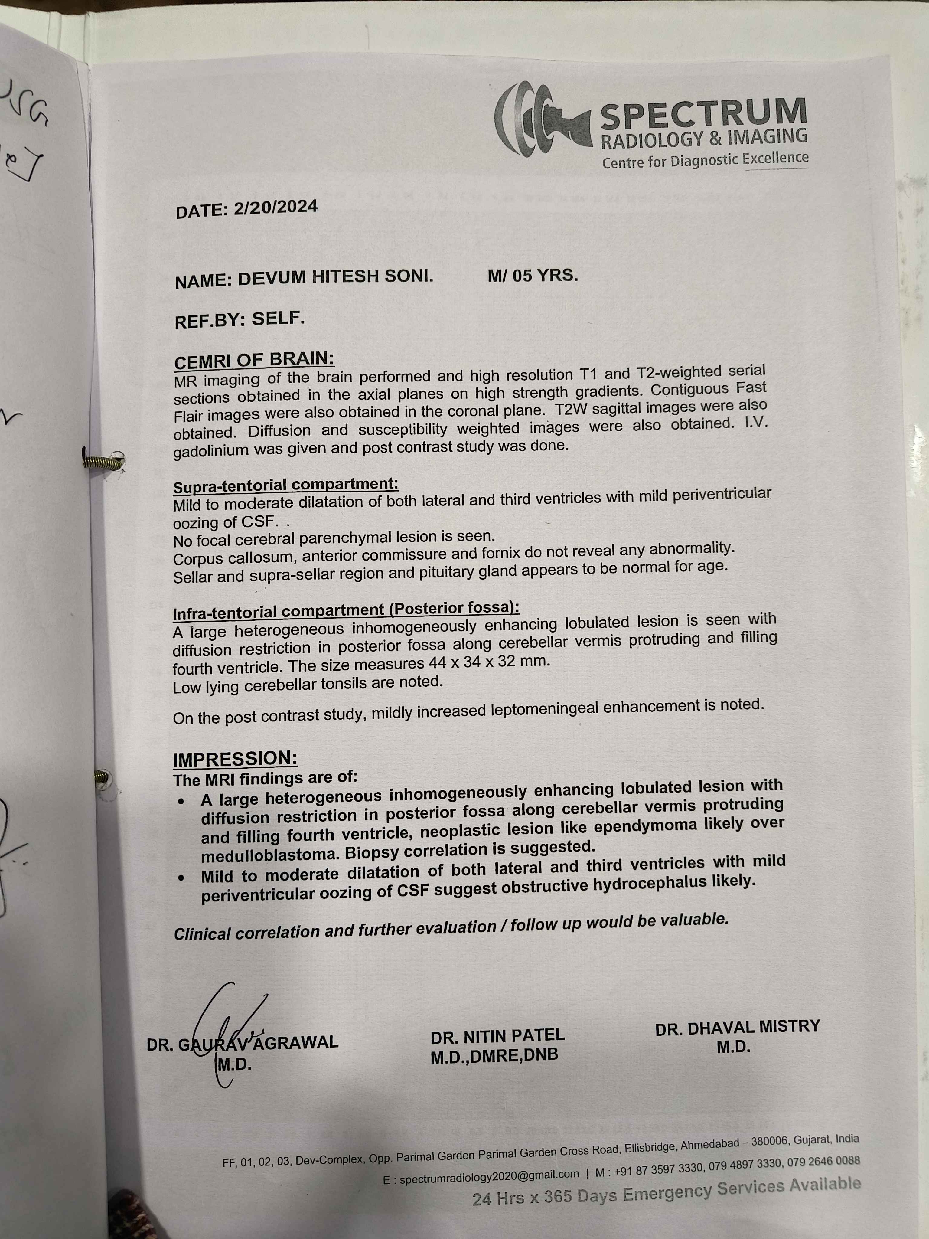 Help Devam My 5 Year Old Son Overcome Medulloblastoma CNS Grade 4 - Ketto