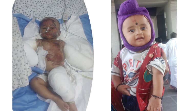 My Baby Battles For His Life And We Need Your Support To Save Him - Ketto