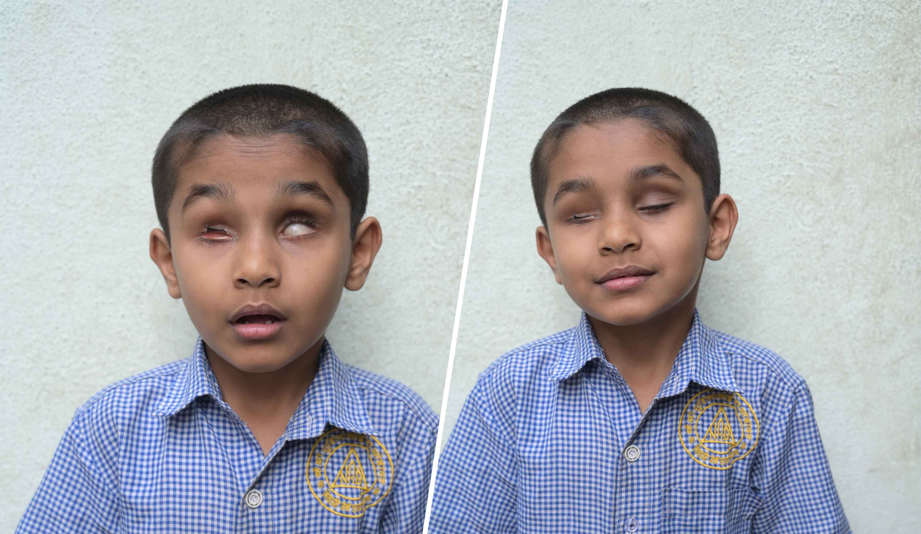 Aryaveer’s Story: A Joyful Heart With A Love For Learning - Ketto