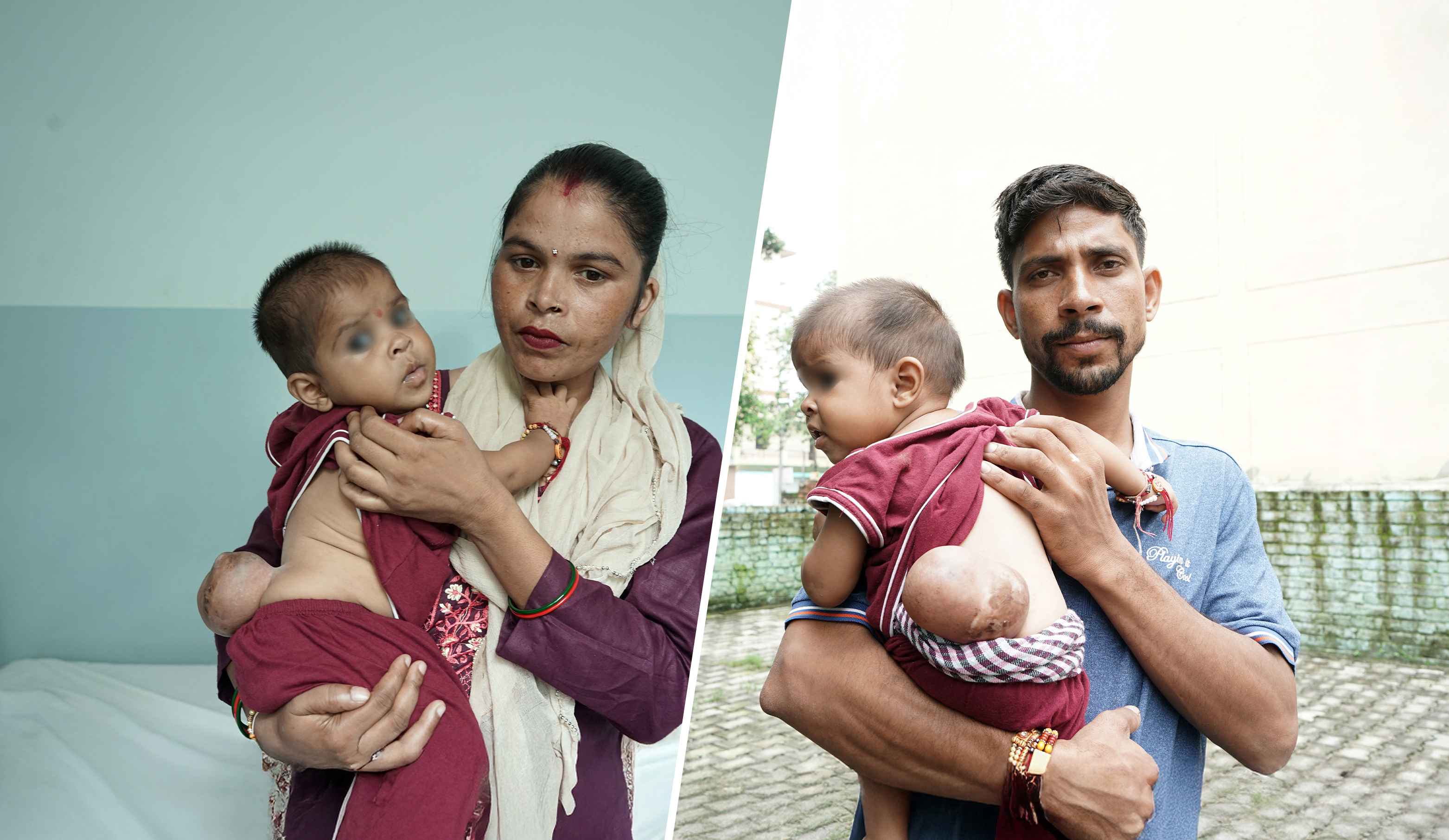 Weighing Less Than 1 Kg, Premature Baby Is Battling Respiratory ...