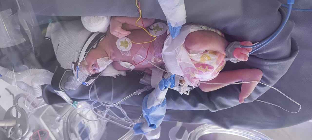 A Tiny Fighter's Battle For Life . We Need Your Help To Provide For Her ...