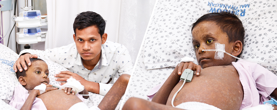 A Rare Skin Disease Has Put My Son’s Life At Risk! Please Help Us - Ketto