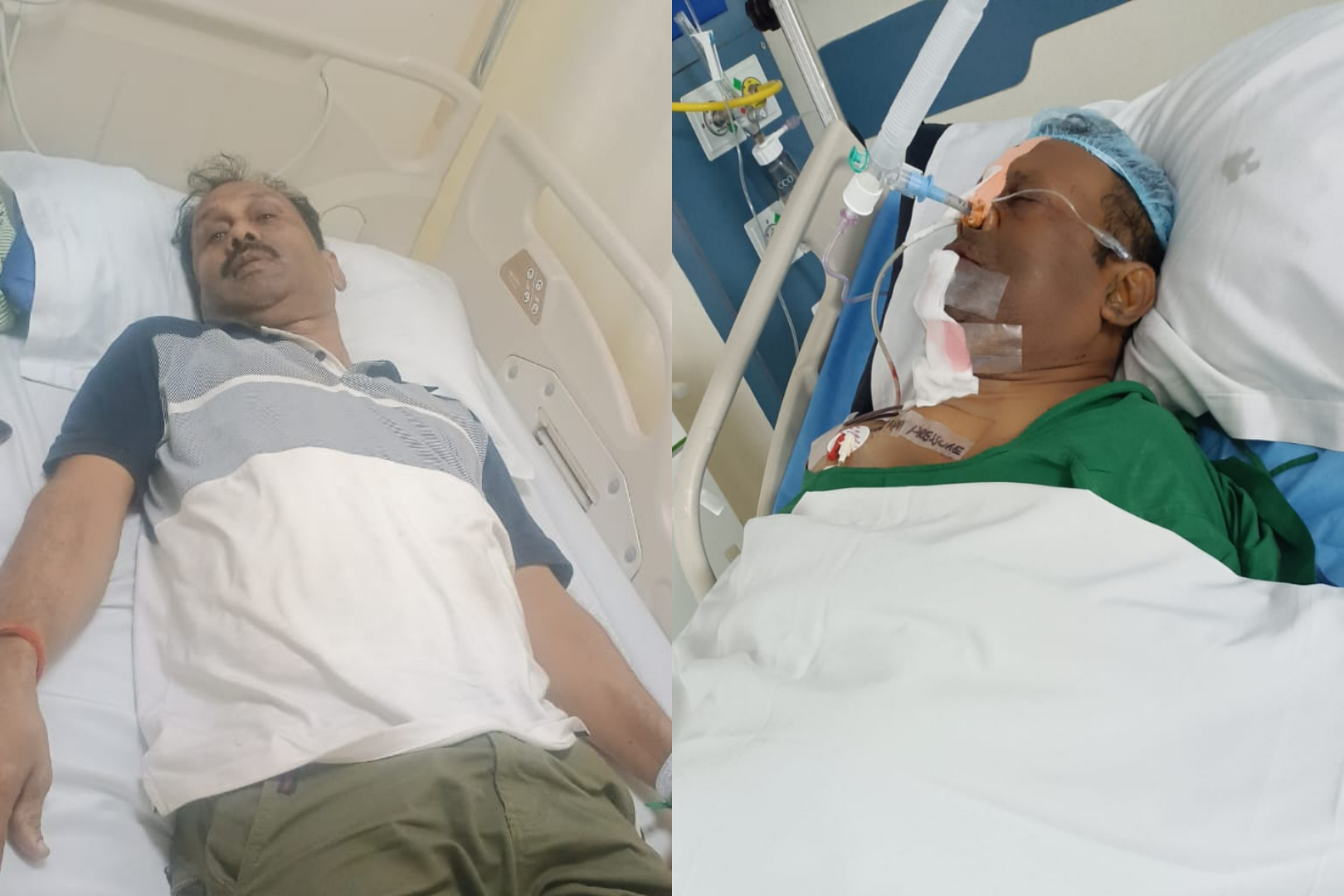 Support Subodh Kumar Gupta's Battle Against Oral Cancer - Ketto