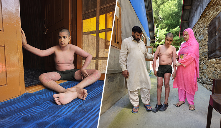 Help My Son Recover From A Rare, Life-changing Condition. - Ketto