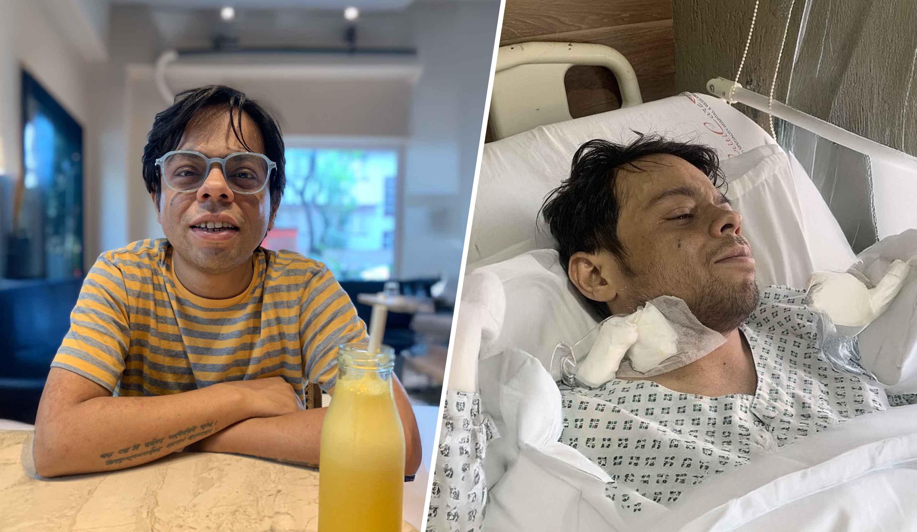 Offer Support To Me, Varun Kulkarni, An Actor & Theatre-Artist In Need ...