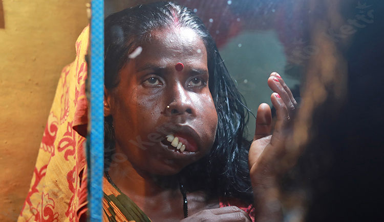 Ramni Begs For Your Support In Her Battle For Healing & Dignity! - Ketto