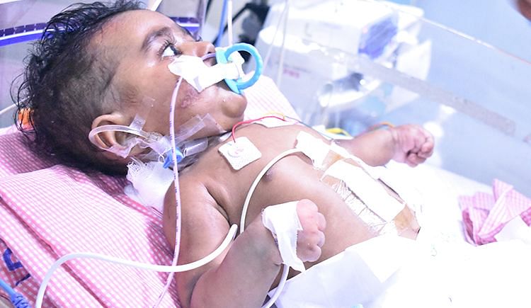 Confined To The Incubator, This 6-month-old Baby Needs Your Help To ...
